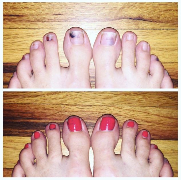 Happy Feet! Foot Care on the Trail Part 2 – Wandering Pine